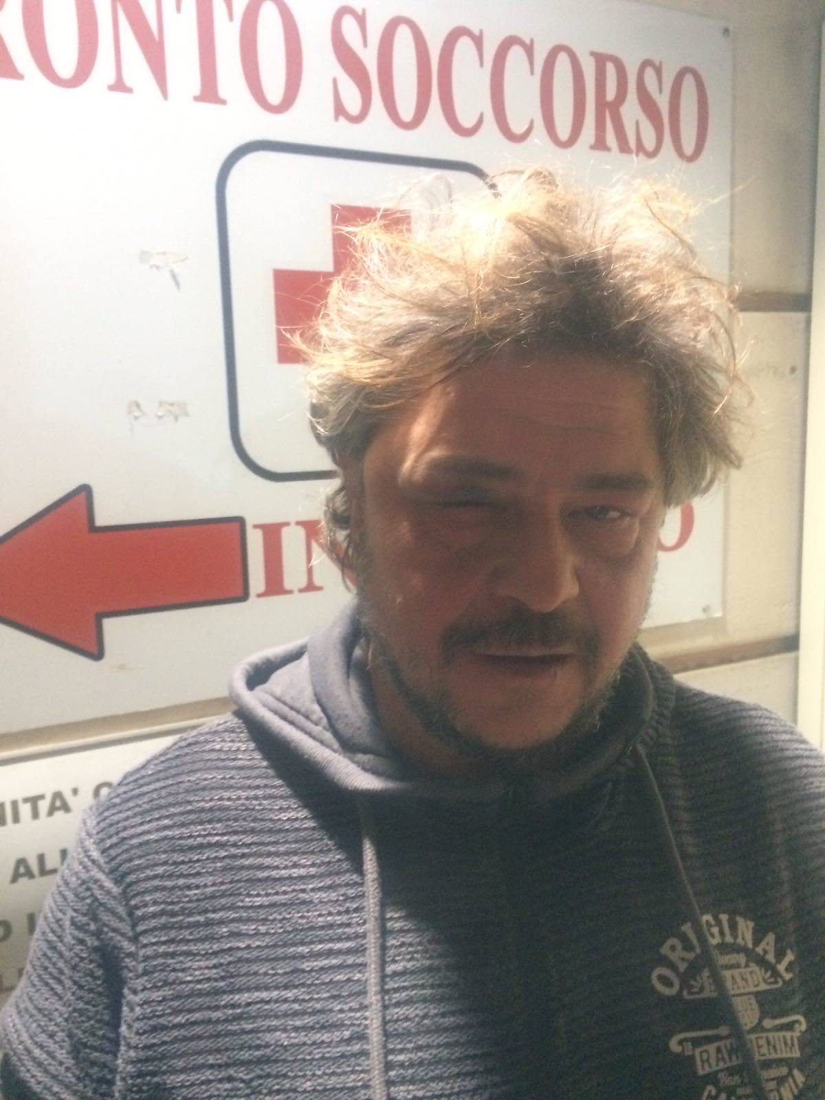 Fisciano (Sa): Poliziotti picchiano violentemente Tony Della Pia ...